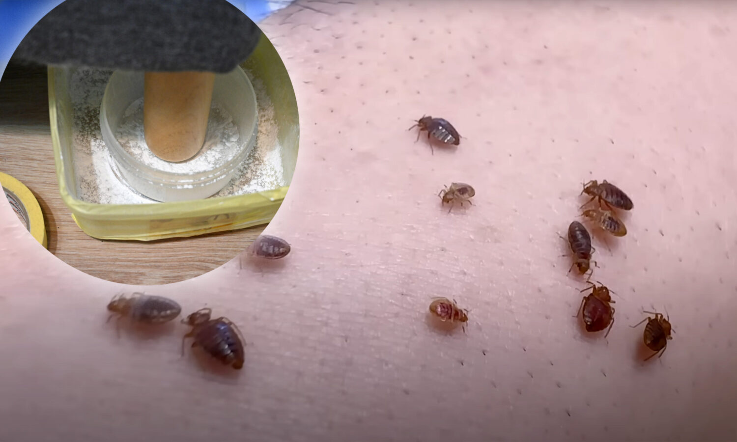 Napravite zamke, spriječite stjenice da vam zaraze krevet i namještaj ...